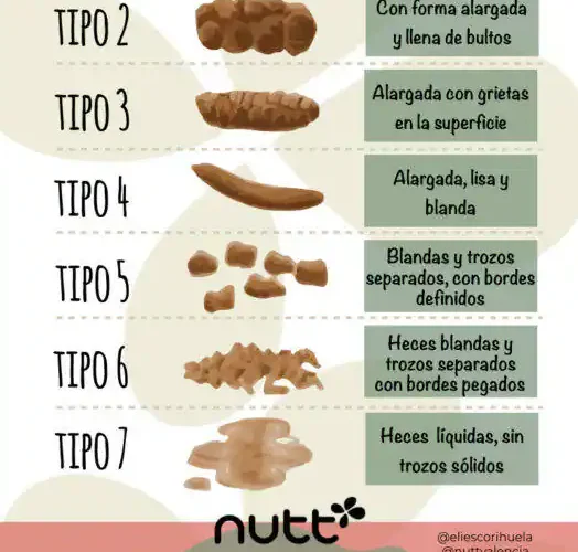 Conoce los diferentes tipos de heces según su color y lo que revelan ...