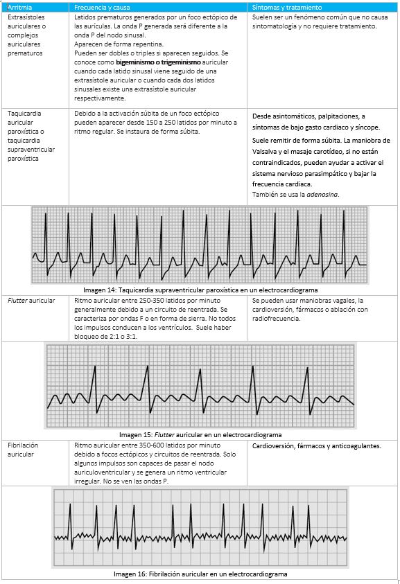 Conoce los distintos tipos de arritmias cardíacas: una guía completa ...
