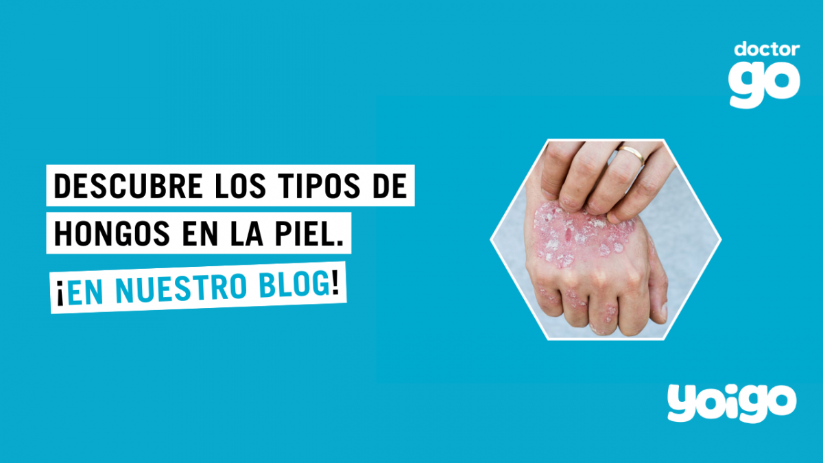 Descubre los diferentes tipos de hongos que pueden afectar tus manos ...